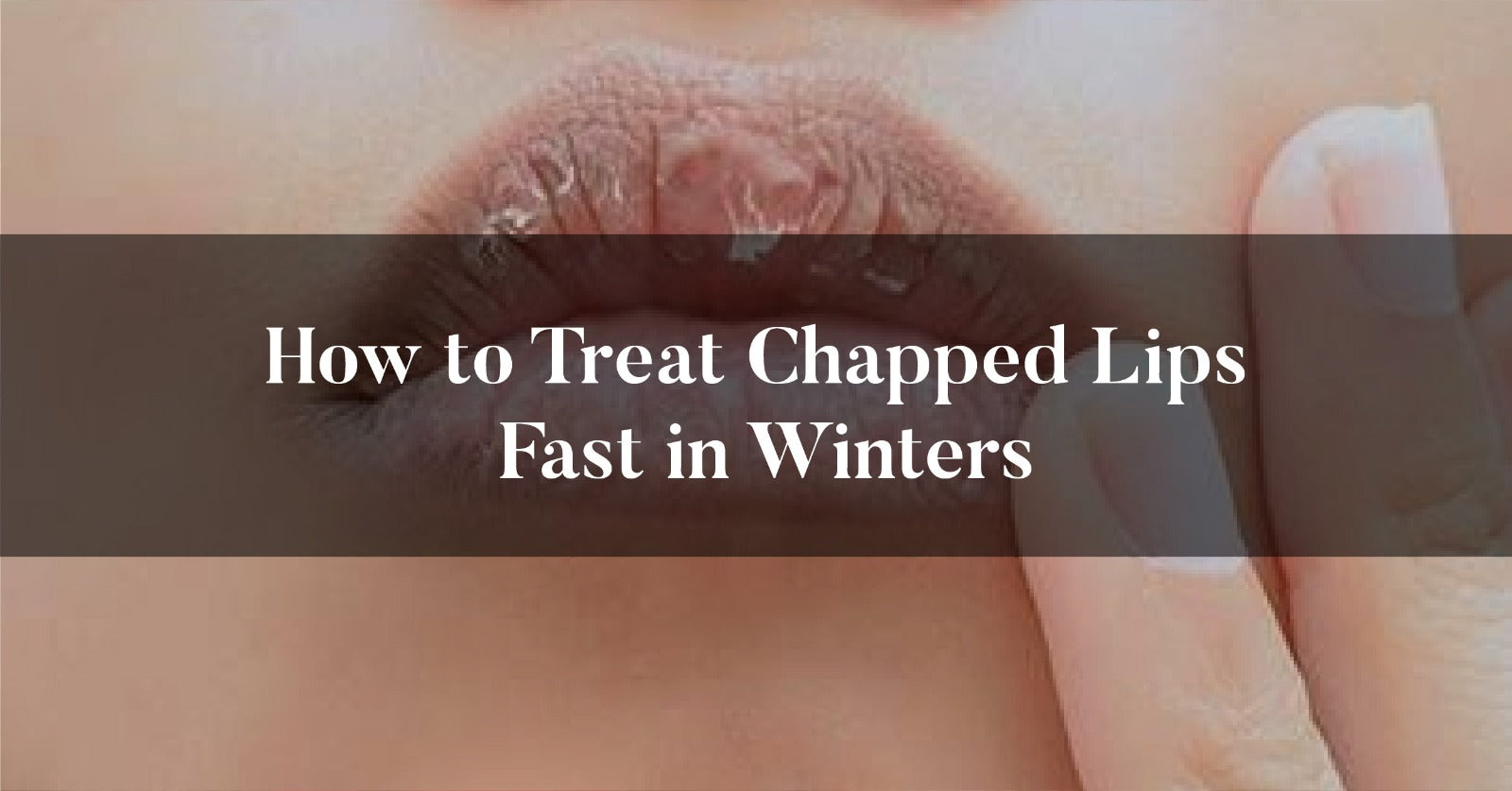 How to Treat Chapped Lips Fast in Winters? – OHRIA AYURVEDA